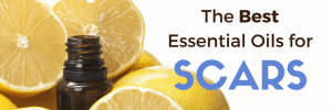 Best Essential Oils for Scars - Acne, Burns & Surgical Scars